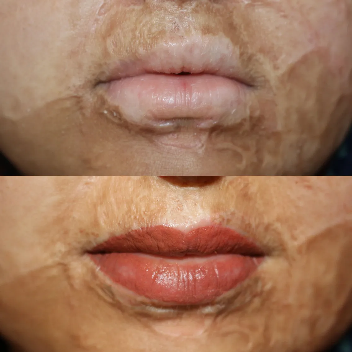 Medical Micropigmentation | Karen Betts Professional