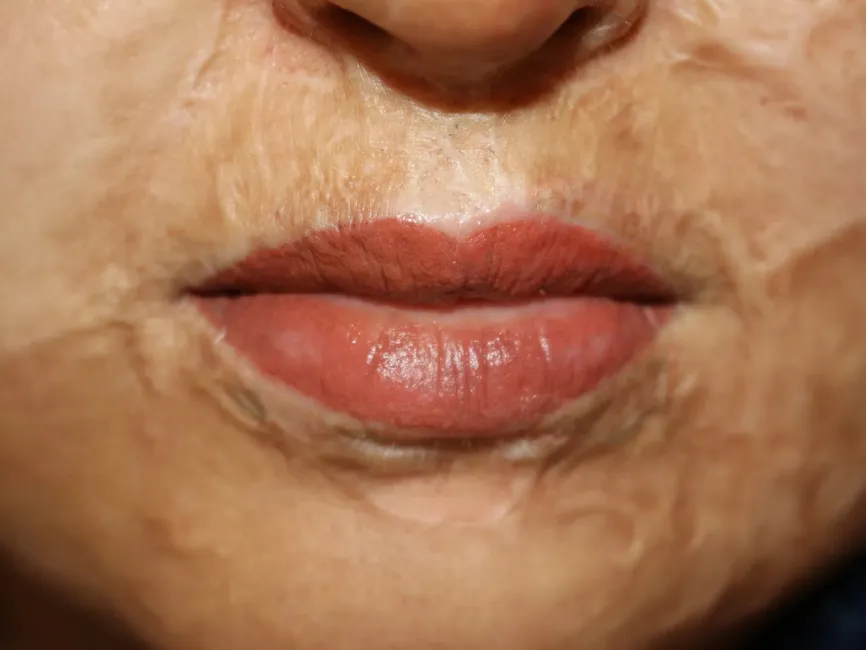 What Is Medical Tattooing? Everything You Need To Know